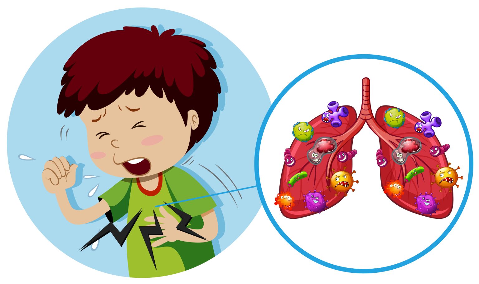 What Really Causes Lung Infections? A Complete Guide to Symptoms ...